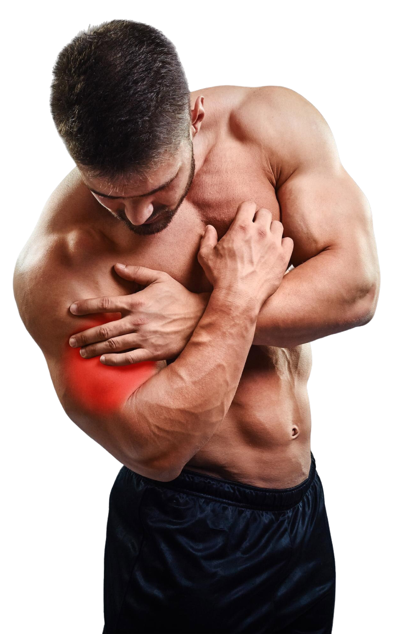 Muscle Strains & Sprains - Reflex PT